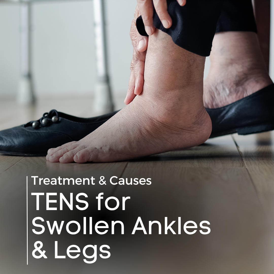 TENS Machines for Swollen Ankles & Legs