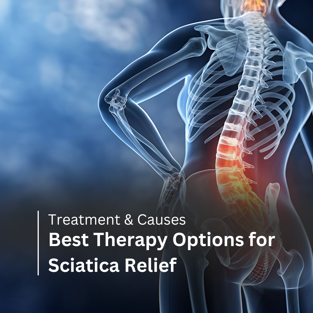 Best Therapy Options for Sciatica Relief | Alternative Therapies