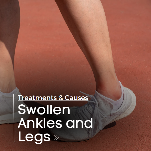 Swollen Ankles and Legs: Causes, Symptoms, and Top Treatment Options